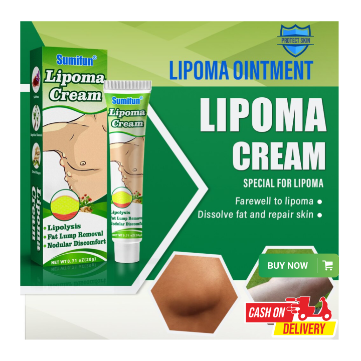 MAGICAL SUMIFUN Lipoma Removal Cream Lipolysis, Fat Lump Removal Cream ...
