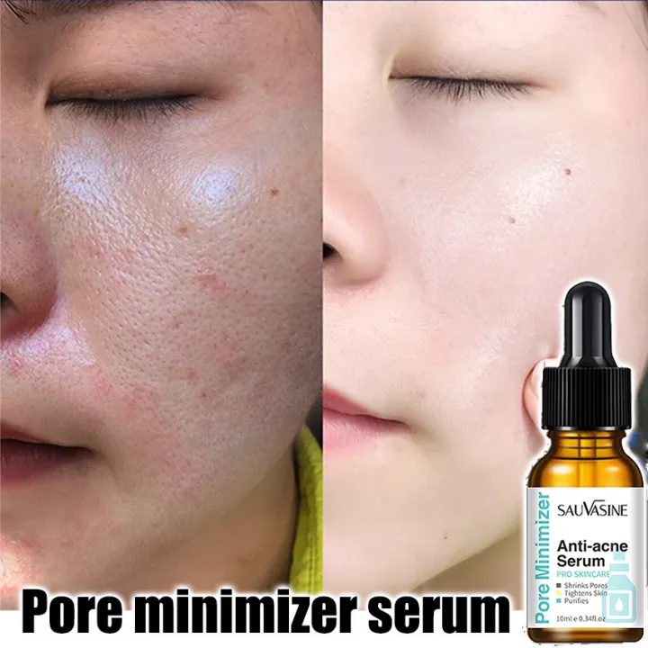 Pore Minimizer Serum Shrink Pores Tightens Skin Purifies Skin Pore ...