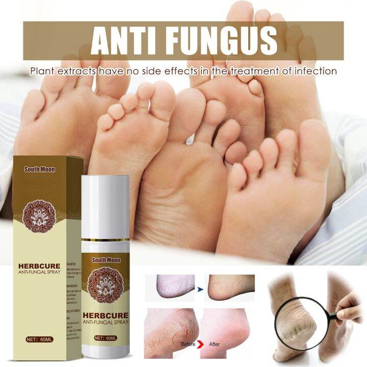 60ml Fungus Fighting Foot Spray Foot Odor Eliminator Anti Fungal ...