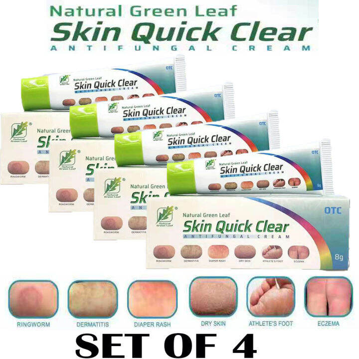 ( SET OF 4 ) Natural Green Leaf Skin Quick Clear Antifungal Cream 8g ...