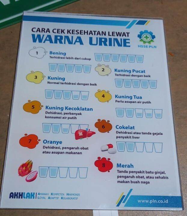 Sign Board warna urine,keterangan warna urine | Lazada Indonesia