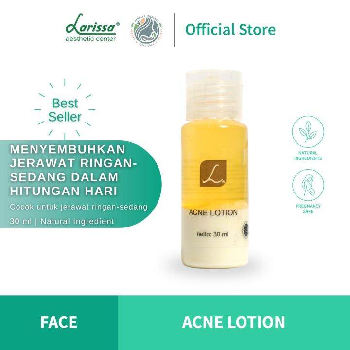 Larissa Acne Lotion | Lazada Indonesia