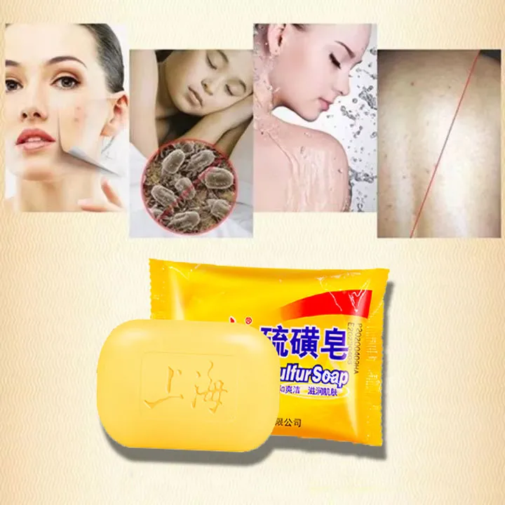 Shanghai Sulfur Soap Oil-Control Acne Treatment Psoriasis Seborrhea ...