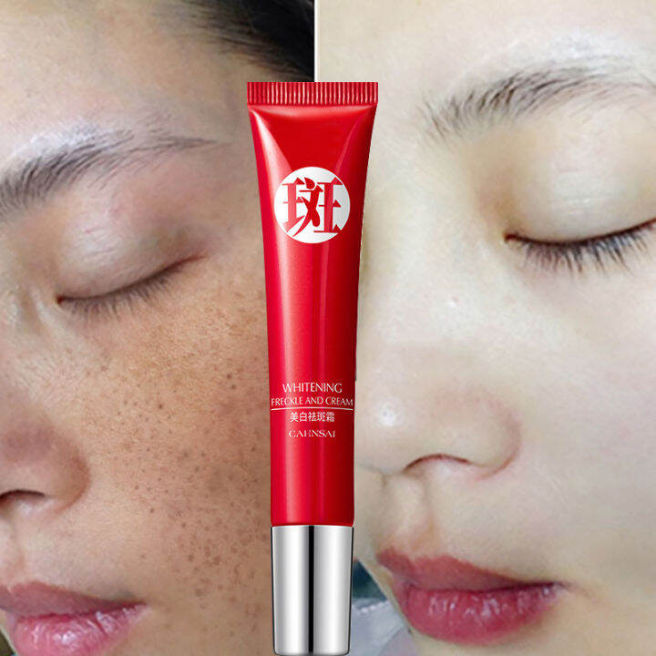 Freckle Remover Whitening Cream 20g Powerful Anti Freckles Face Cream ...