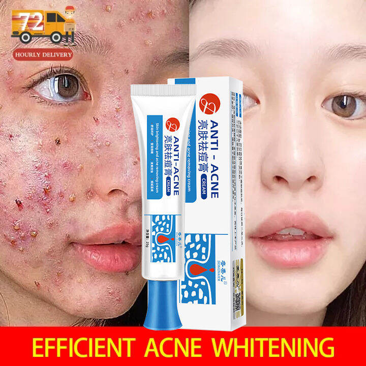 Genuine 100% Effective Yanchuntang Acne-removing Acne Pit Repair Scar ...