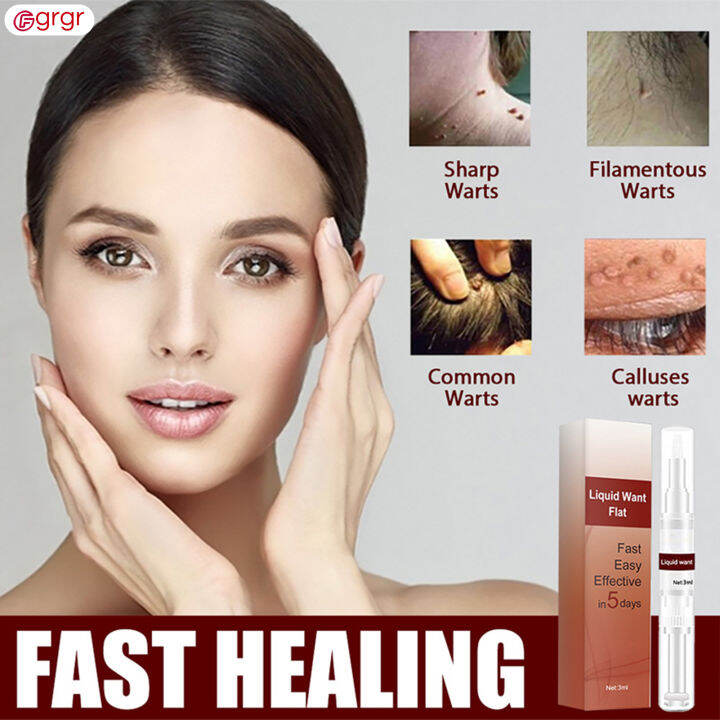 Fgrgr Wart Removing Liquid Essence Universal No Stimulation Wart ...