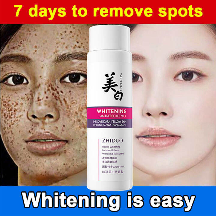 Whitening Freckle Cream Ultimate Pekas Cream for Face Freckles Melasma ...