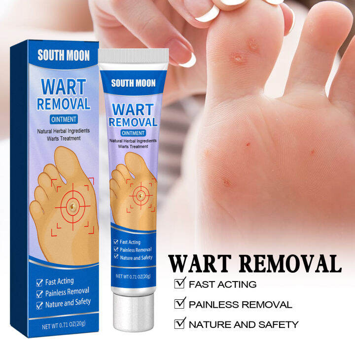 South Moon To Remove Corn Plaster Grams Of Wart, Flat Verruca Plantaris ...