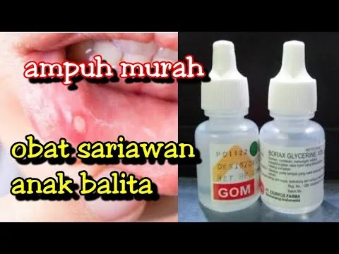GOM 8 ml - Obat Sariawan Bayi dan Balita - Slime CITO | Lazada Indonesia