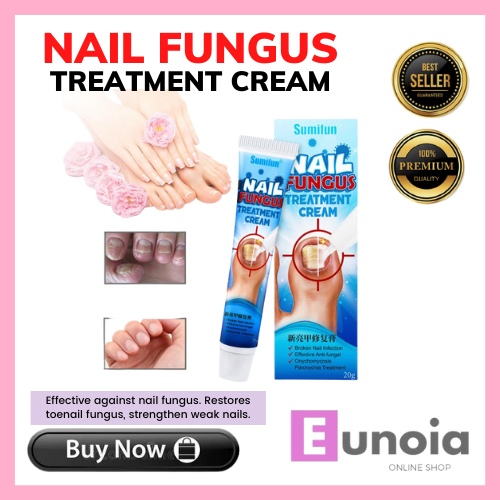 [sumifun Nail Fungus Treatment Anti Fungal Cream 20g] Fungisol