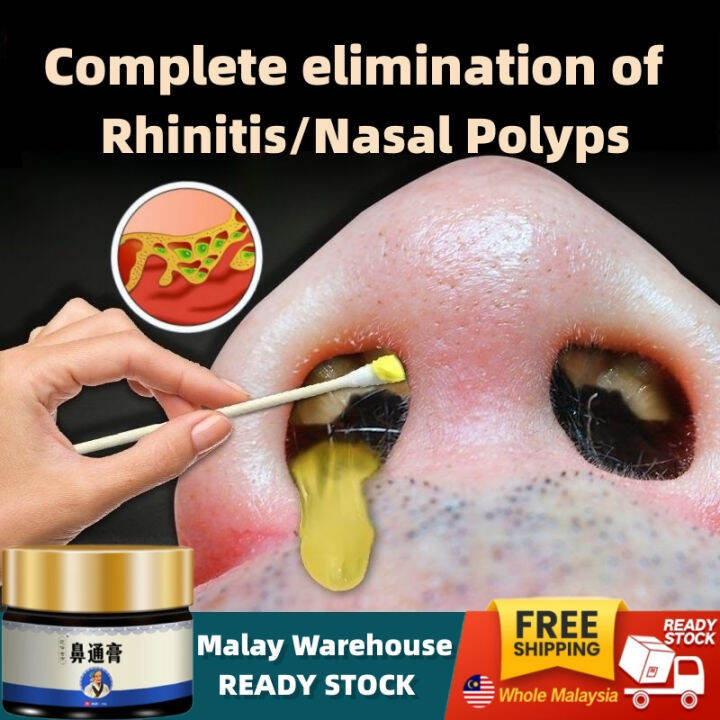 Ubat Resdung Keluarkan Hingus Pekat Sinus Care Hidung Tersumbat ...