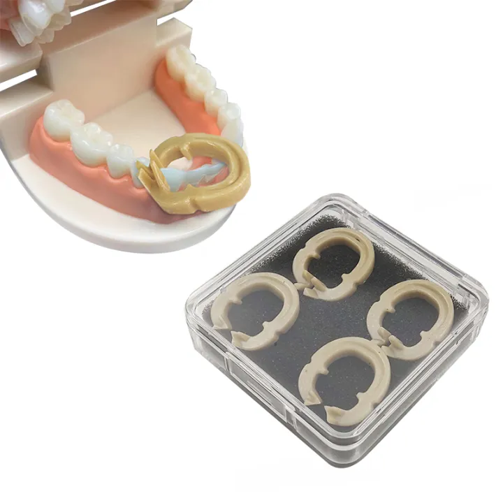 Dental Resin Clamping Ring Matrix Separating Ring Sectional Contoured ...