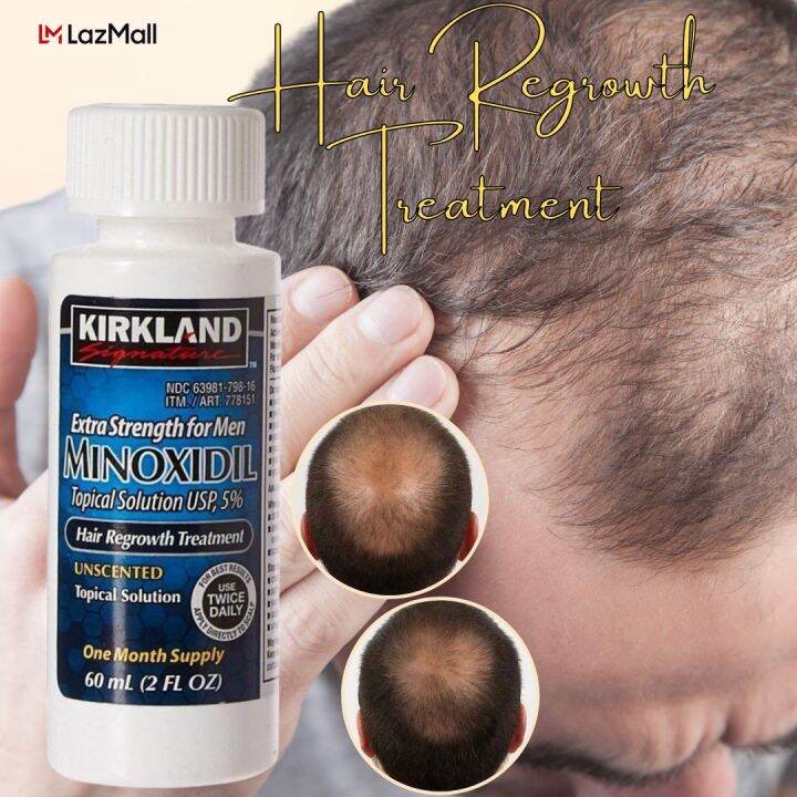 Kirkland Minoxidil Extra Strength For Men Hair Regrowth Treatment For