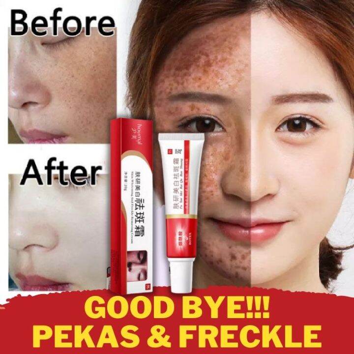 A.one Effective Melasma Cream Pekas Remover Collagen Spot Removing Face ...