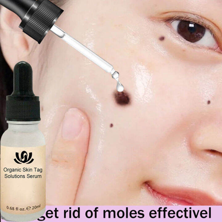 Hailicare Skin Tag Remover Wart Mole Remover Serum Fade Freckles Spots ...