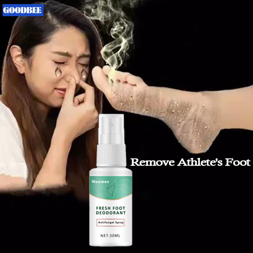 Foot Odor Spray Antibacterial Deodorant Powder Anti Itch Sweat Odor ...