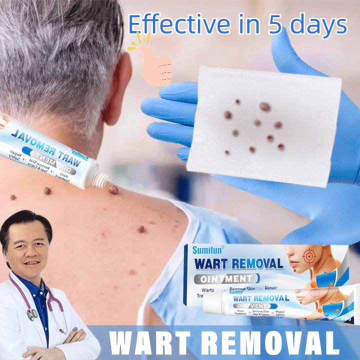 warts remover original watson warts removal original cream mole and ...