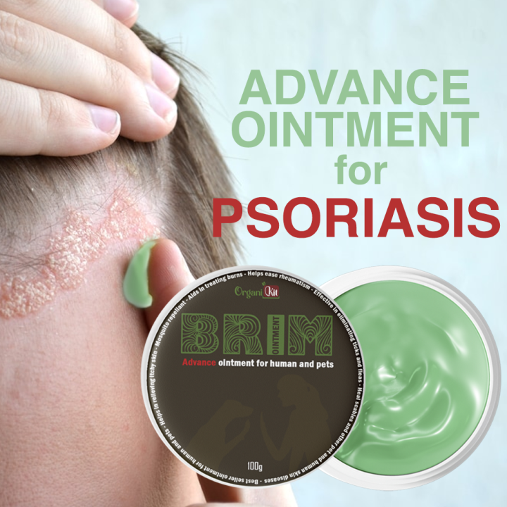 BEST SELLER BRIM ADVANCE OINTMENT / Psoriasis ointment eczema ointment ...