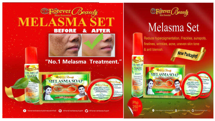 MELASMA SET( Toner 60mlx1, Night Cream 10gx1, Sunblock spf60 10gx1, Soap 135gx1) By Forever ...
