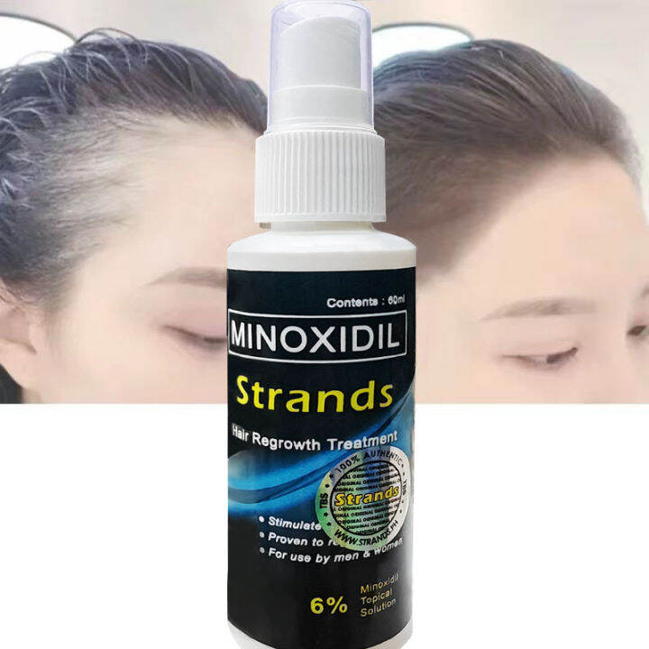 Strands Minoxidil 6% Solo Hair Grower Beardgrower for Men & Women (60ml ...