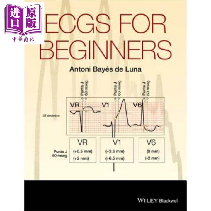 ECG beginner course ECGs for beginners English original Antoni Bay é s ...