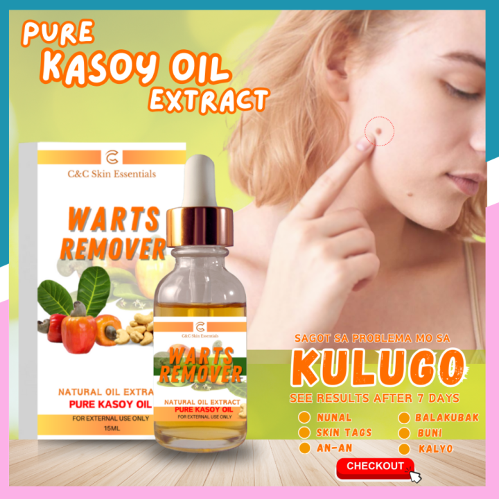 Original Pure Extract Kasoy Oil Warts Remover: Painless Solution for ...