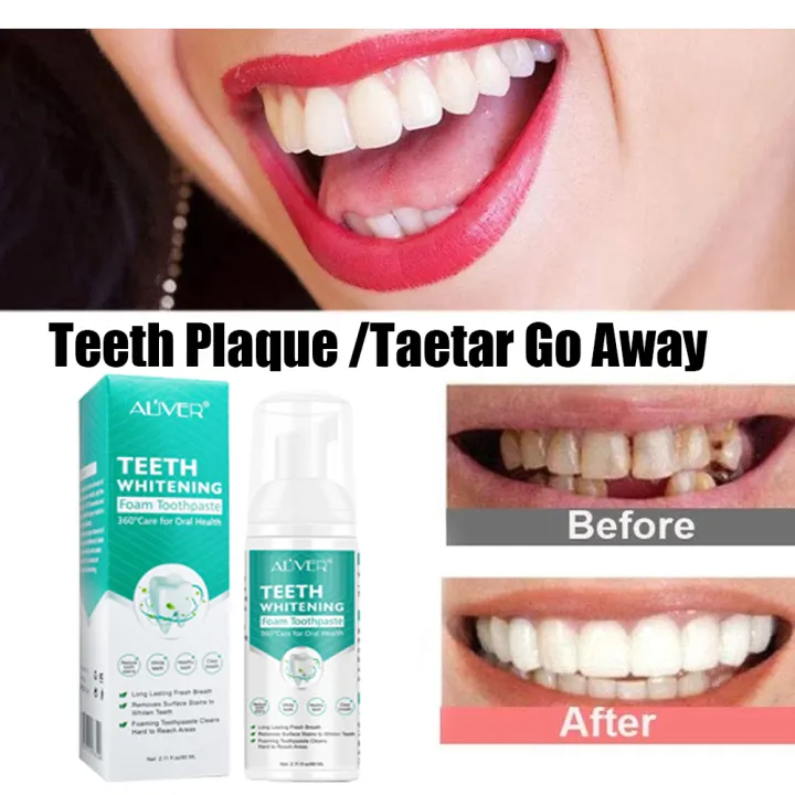 Local delivery ALIVER Cleaning Teeth Whitening Mousse Foam Toothpaste ...