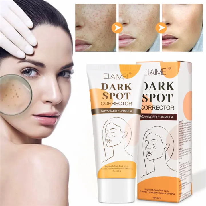 ELAIMEI Dark Spot Corrector Cream Whitening Freckle Cream Powerful Removing Melasma Melanin Dark ...