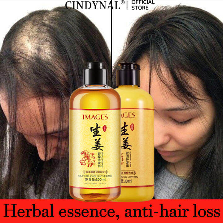 CINDYNAL Ginger Hair shampoo Anti Hair Loss Nourish Hair Fast Growth Shampoo Oil Control Anti ...