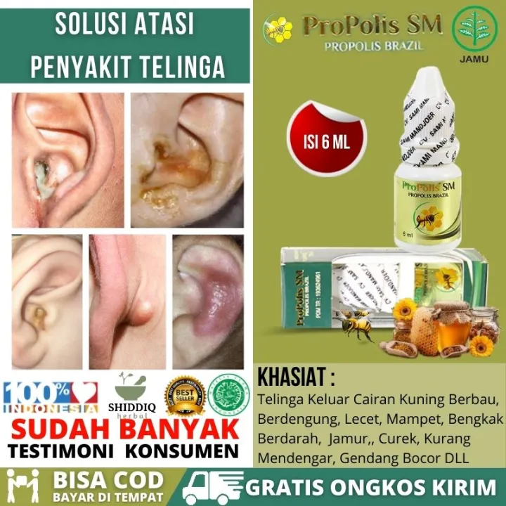 Obat Radang Telinga Bagian Dalam, Penyakit Labirinitis, Obat Radang ...