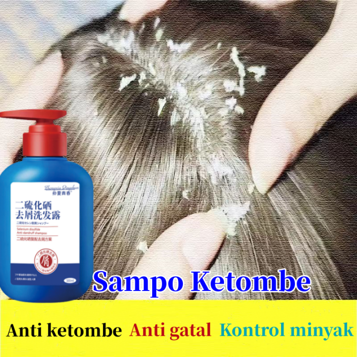 Penghilang Ketombe Ketombe Pembersihan Lembut Dan Pengontrol Minyak Melembabkan Akar Rambut ...