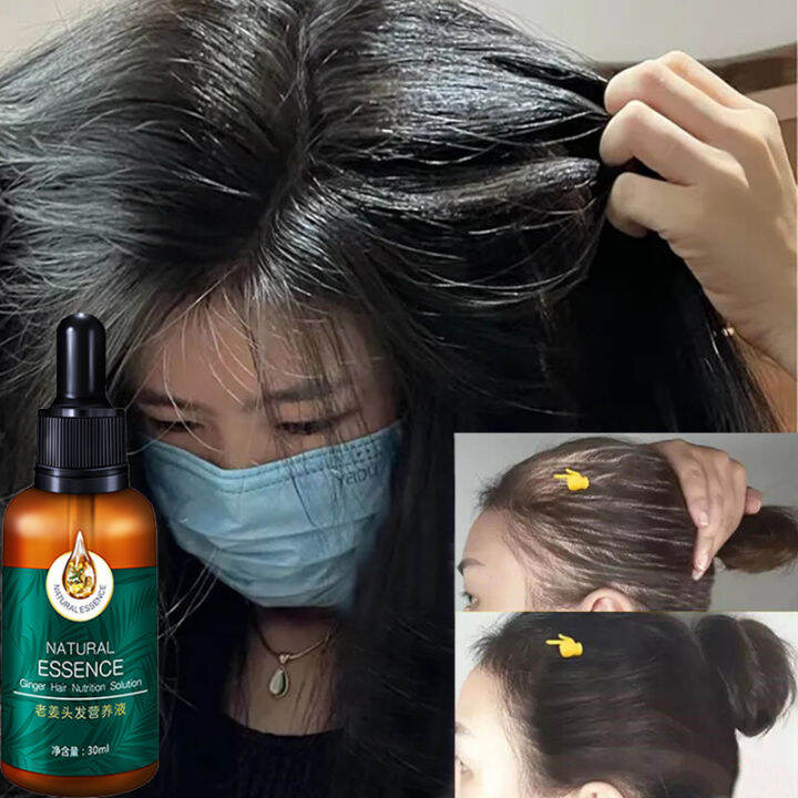 【thicker Hair In 7 Days】hair Serum Hair Grower Fast Long Hair Treatment