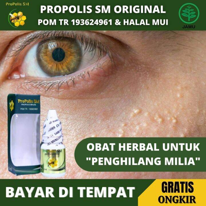 Obat Oles Penghilang Milia di Bawah Mata Bintik Putih Di Ujung Mata ...