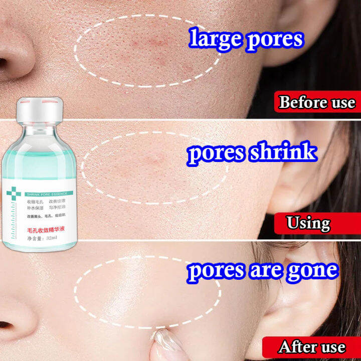 Pore conditioning essence Removing facial pores shrinking pores ...