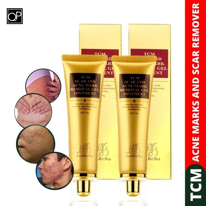 B1T1 LANBENA TCM Stretch Marks Remover | Scars and Acne Marks Removal ...