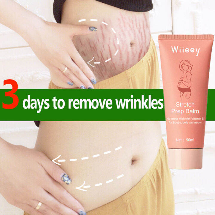 stretch mark remover strechmark removal original Improve and eliminate ...
