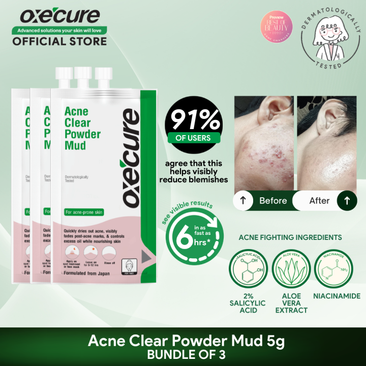 OXECURE Acne Clear Powder Mud, Bundle of 3 | Lazada PH