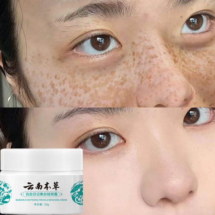Japanese Melasma Cream Yunnan Herbal Whitening Freckle Cream Japanese ...