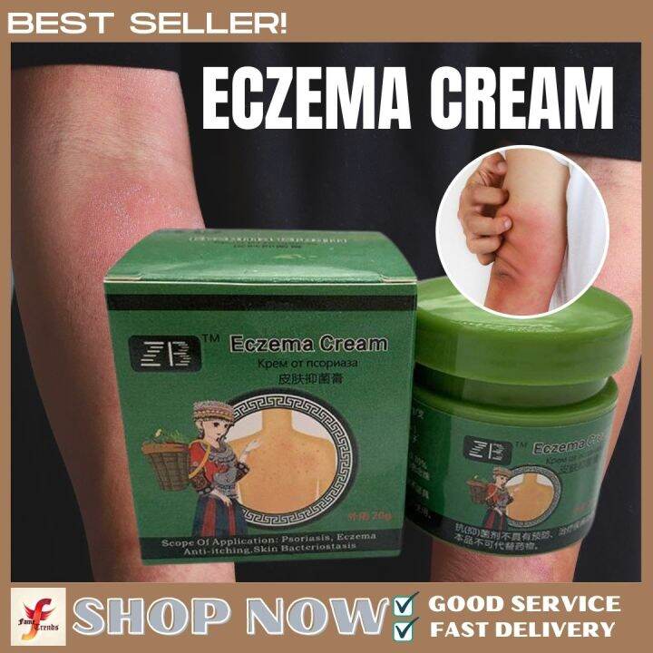 Best Seller Eczema Cream Antibacterial Skin Psoriasis Cream