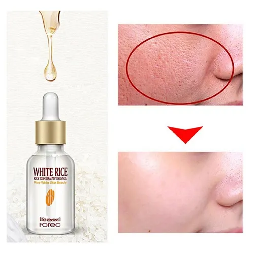 ORIGINAL ROREC White Rice Serum Natural & Organic Reduces Wrinkles ...