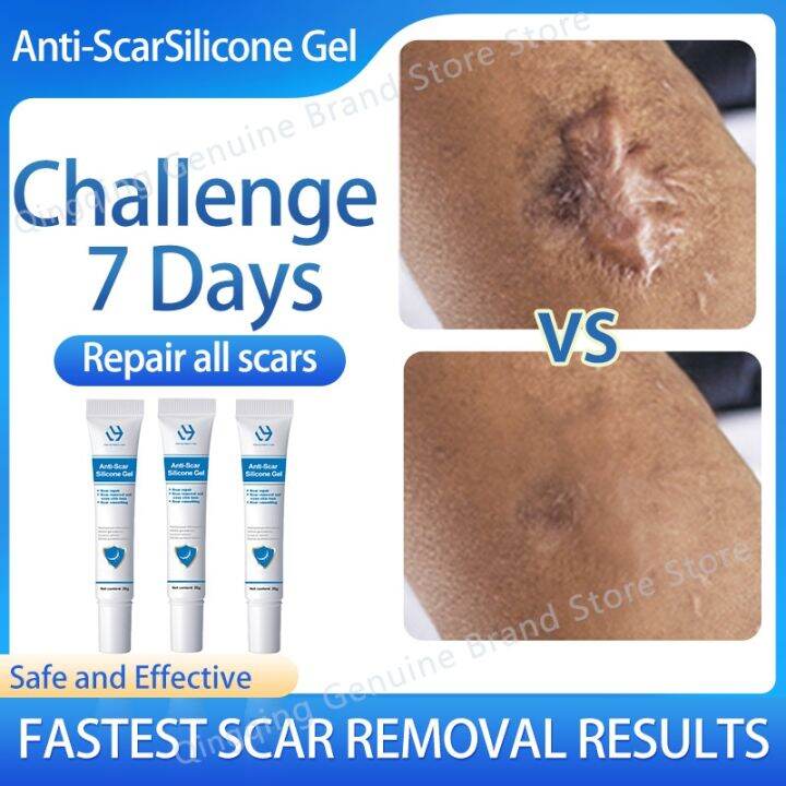 Scar cream gel effective repair surgical scars stretch marks acne pits ...
