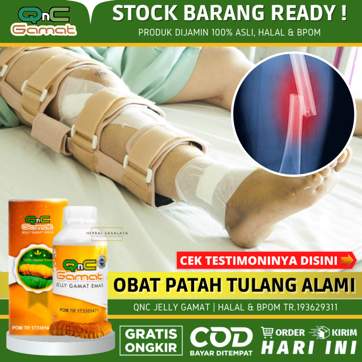 QNC JELLY GAMAT - Obat Patah Tulang yang 100% ALAMI, Tulang Retak ...