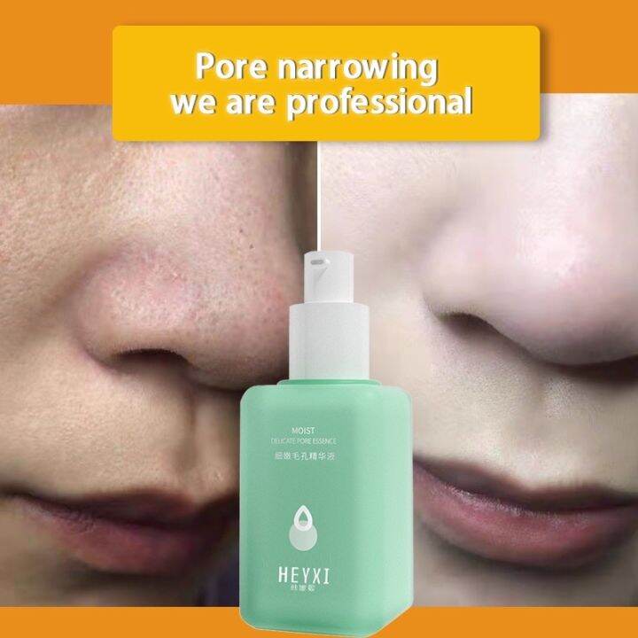 HEYXI PORE SERUM MINIMIZER Acid Serum Pores Remover Minimize Pores ...