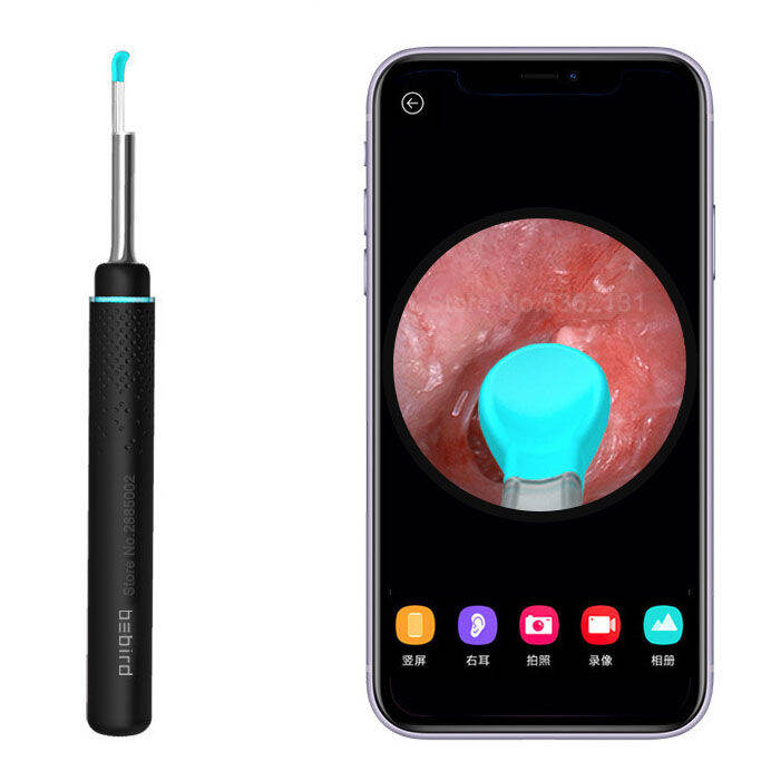 Alat Pembersih Telinga Kamera Endoscope Visual Earpick Android / Korek ...