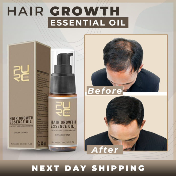 [authentic] Purc Hair Growth Essence Oil 20ml Hair Serum Anti Hairfall