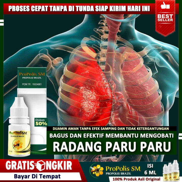 Obat Radang Paru Paru, Radang Paru Paru Anak, Batuk Radang Paru Paru ...