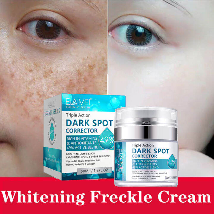 ELAIMEI Dark Spot Corrector Cream Whitening Freckle Cream Powerful Removing Melasma Melanin Dark ...