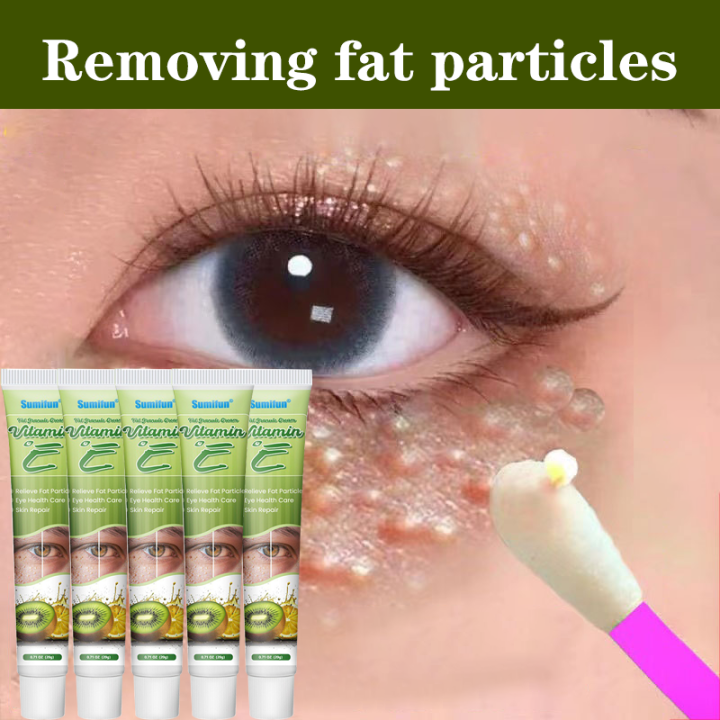 Syringoma eye removing magic device to remove fat particles Syringoma ...