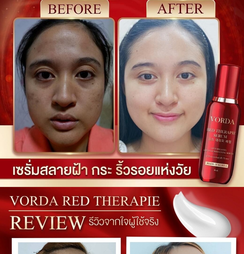 Vorda Red Therapie Serum วอด้า เซรั่ม [30 ml./ขวด] [1 ขวด] Vorda Serum เซรั่มดิว อริสรา เซรั่ม ...