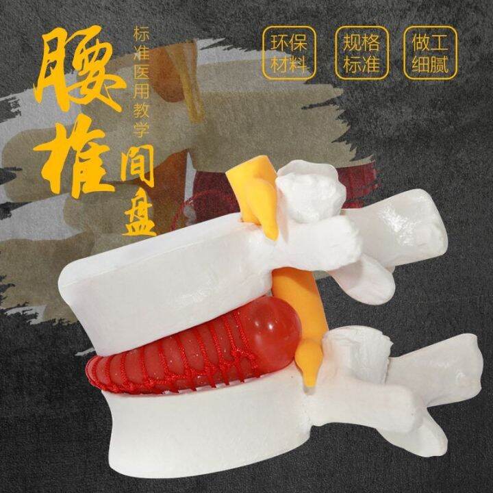 Lumbar Disc Demonstration Model Spinal Pressure Measurement ...